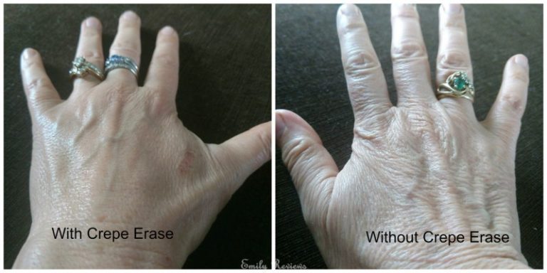 Crepe Erase Anti-Aging Starter Kit ~ Review | Emily Reviews