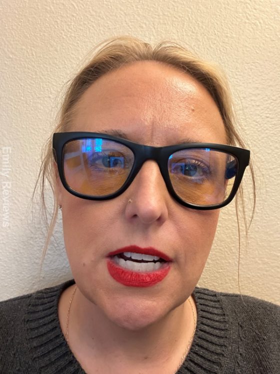 Get a Brighter Smile with Moon Oral Beauty’s Platinum Express ...